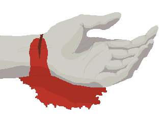 Slit Wrist @ PixelJoint.com